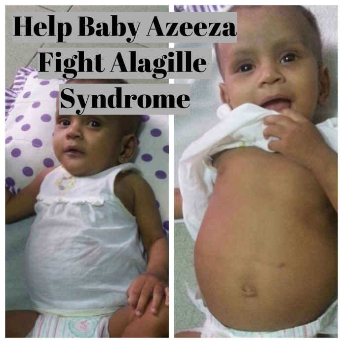 Save Baby Azeeza | LaunchGood