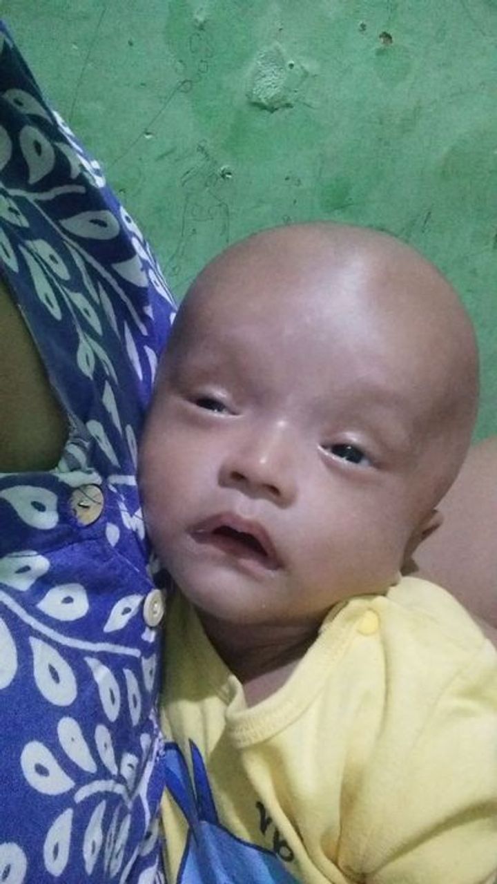 URGENT! HELP LITTLE KAIVAN TO RECOVER FROM HYDROCEPHALUS | LaunchGood ...