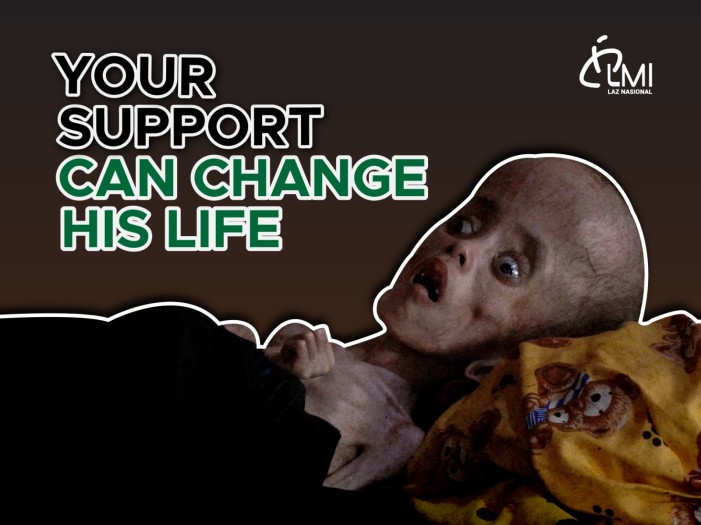 Help Sifa Fight Hydrocephalus | LaunchGood | LaunchGood