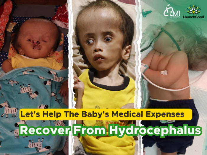 Support For Children with Hydrocephalus | LaunchGood | LaunchGood