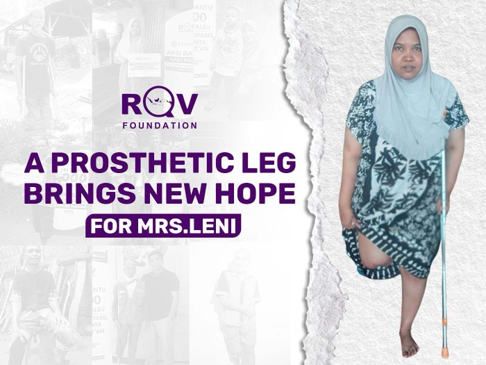Help Mrs. Leni Work with a Prosthetic Leg! | LaunchGood | LaunchGood