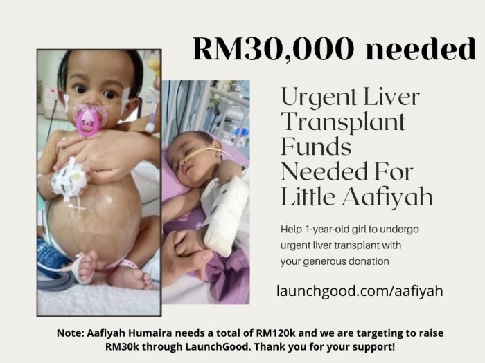 Help this little princess Aafiyah Humaira for Urgent Liver Transplant ...